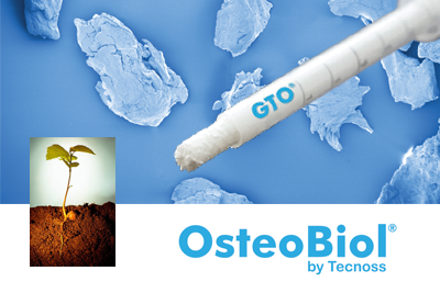 State-of-the-art Second Generation GBR material! - Dentistry Show ...