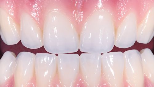 Zirkonzahn - Dental Technology Showcase 2023