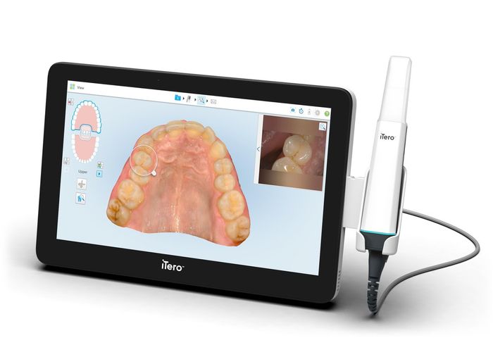 iTero Lumina intraoral scanner - BDIA Dental Showcase 2024